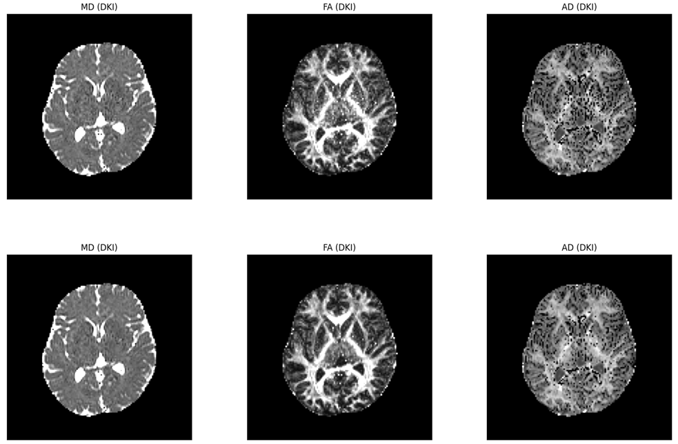 【DIPY】DIPYを用いた拡散MRIのノイズ除去 ~Denoise~