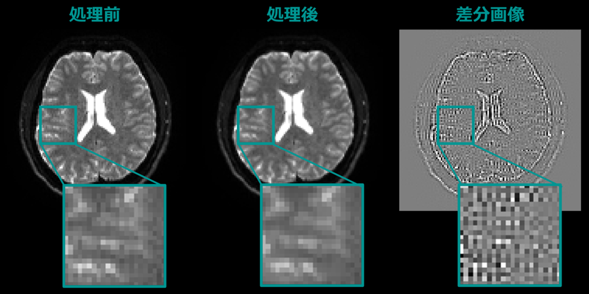 【MRtrix】MRtrixを用いたギブズのリンギングアーチファクト（Gibbs ringing）の除去