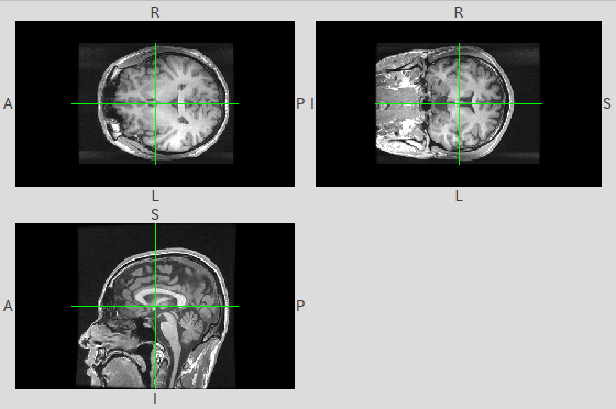FSLViewで画像が正しい向きで表示されない時