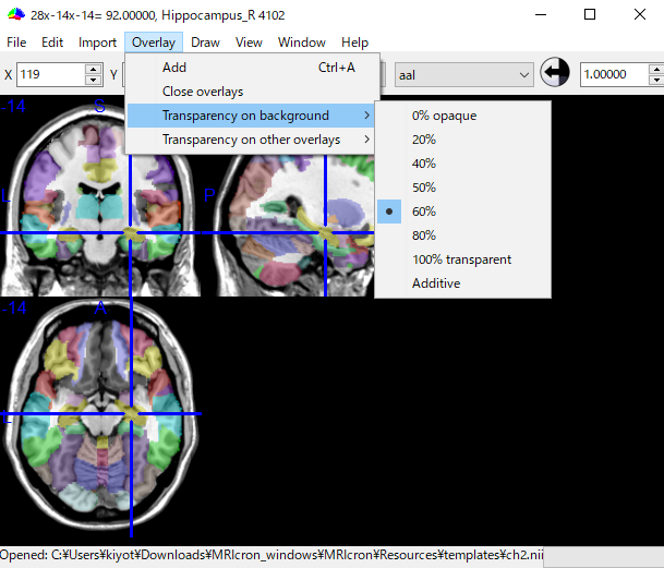 WindowsでのMRIcronのインストール方法